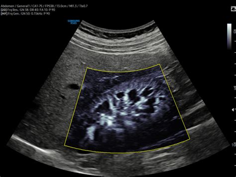 Ultrasound Image Gallery Thesuite Learn Without Limits
