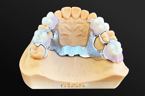 3d 레이저 소결 프린터 20 50 μm Dmls 금속 치과 보철물 3d 인쇄기