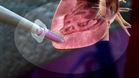 Grow Organs On Your Own Stem Cell Youtube