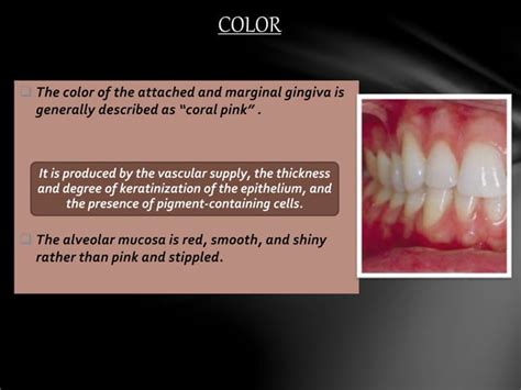 Clinical Features And Stages Of Gingivitis Pptx