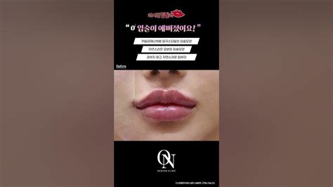 자연스러운 오버립 입술모양 러시안립필러 👄 다시온의원 강남피부과 강남역 강남역피부과 입술필러 입술필러잘하는곳 러시안립필러 Youtube