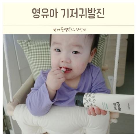 영유아 여아 기저귀발진 심할때 원인 관리방법 몽디에스 후기 네이버 블로그