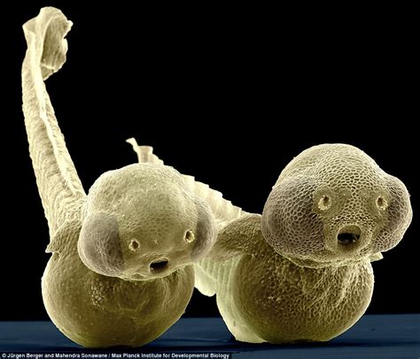 Tadpole Under A Microscope Rpics