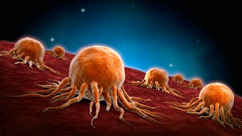An Unstoppable Killer New Research Suggests Cancer Can T Be Eradicated NPR