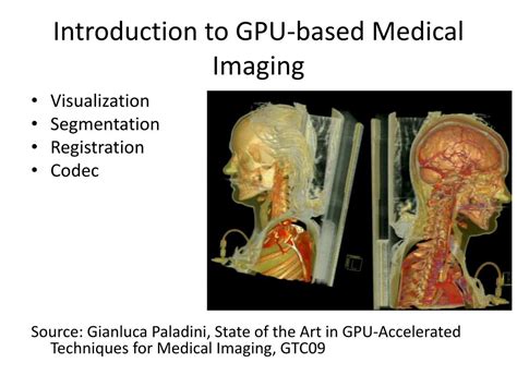 Ppt Some Applications Of Gpu Based Medical Imaging Powerpoint
