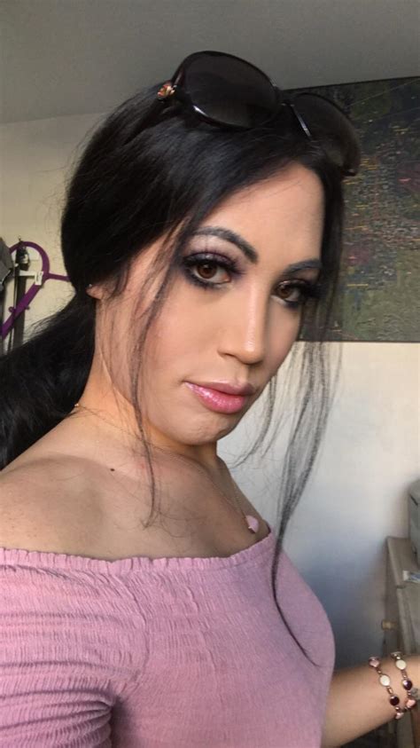 25 Post Op Mtfhow Am I Doing Rtranspassing