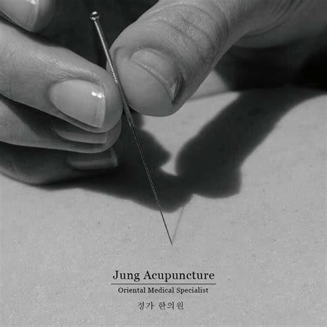 Korean Triangular Acupuncture Therapy