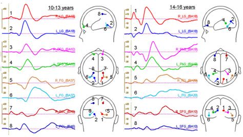 Dipole Source Waveforms And Cortical Locations Besa Solutions For 10