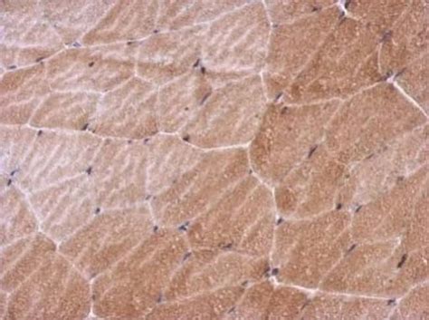 Tk1 Rabbit Anti Human Mouse Polyclonal Invitrogen 100 µl