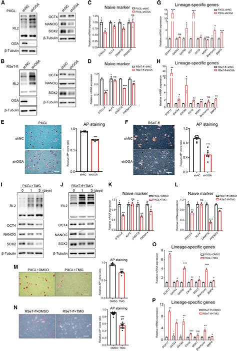 O Glcnacase Regulates Pluripotency States Of Human Embryonic Stem Cells