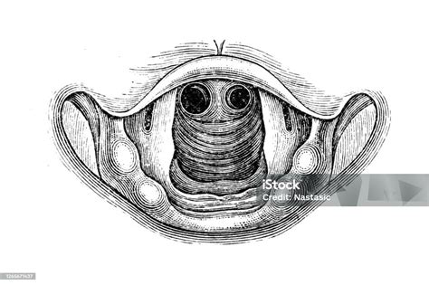 Gambar Laringoskopi Dinding Posterior Laring Dan Trakea Ilustrasi Stok