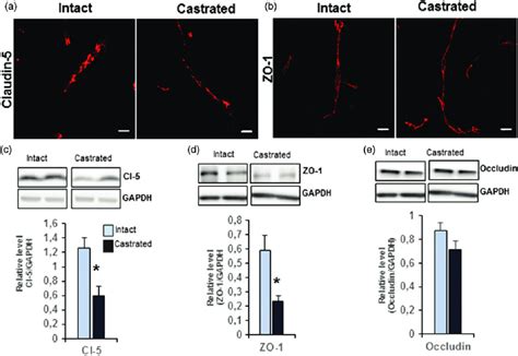 Depletion Of Gonadal Testosterone Affected Endothelial Tight Junction