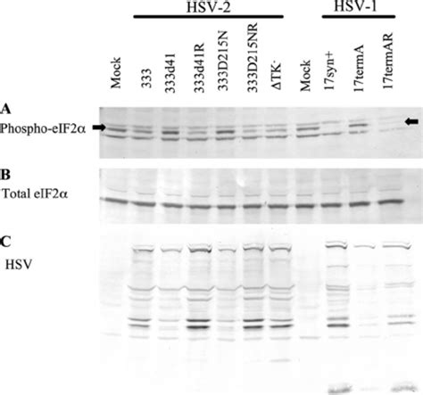 Accumulation Of Phosphorylated Eif2 ␣ Phospho Eif2 ␣ Is Associated
