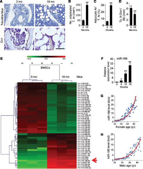 Figure 1 From Microrna 188 Regulates Age Related Switch Between