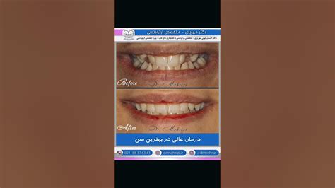 درمان عالی در بهترین سن دکتر احسان ابویی مهریزی Youtube