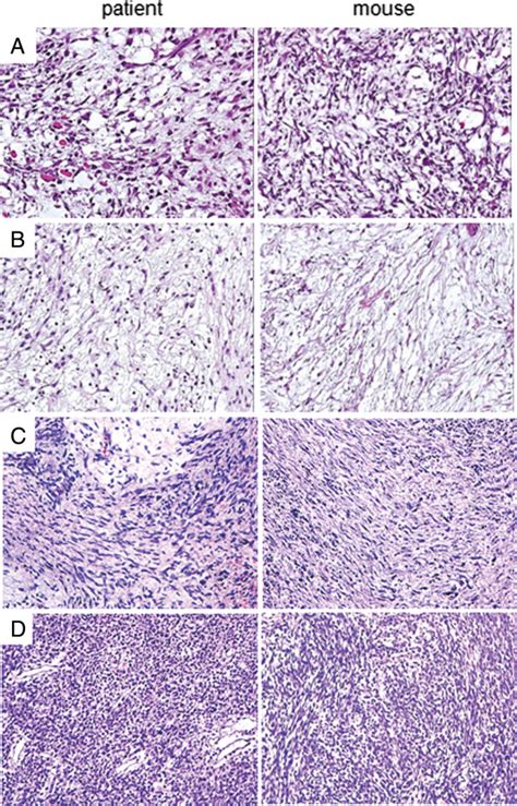 Histopathology Of Human Tumor And Xenografted Tumors Histopathology Of