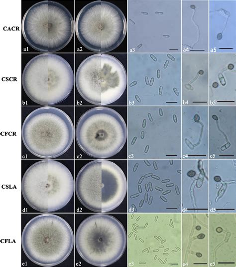 Frontiers Colletotrichum Spp Diversity Between Leaf Anthracnose And