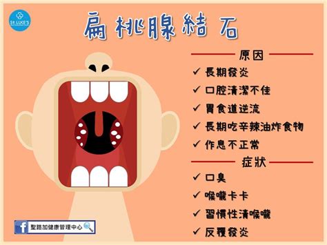 嘴飄異味、味覺異常、耳朵痛？你扁桃腺可能結石了 祝你健康 三立新聞網 Healthsetncom