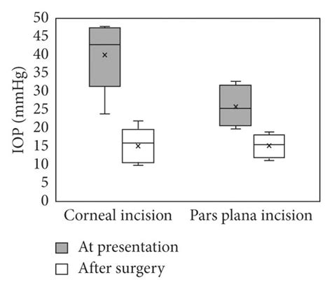 E Schematic Showing The Anterior Vitrectomy Via A Pars Plana Approach