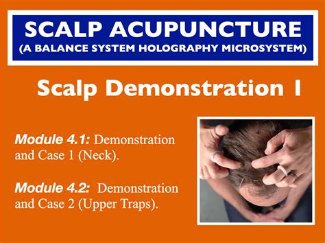 Scalp Acupuncture A Balance System Holography Microsystem