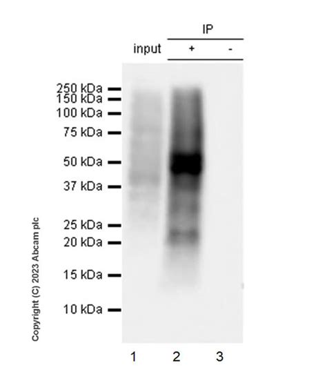 Anti Puromycin Antibody [epr27218 173] Ab315887 Abcam