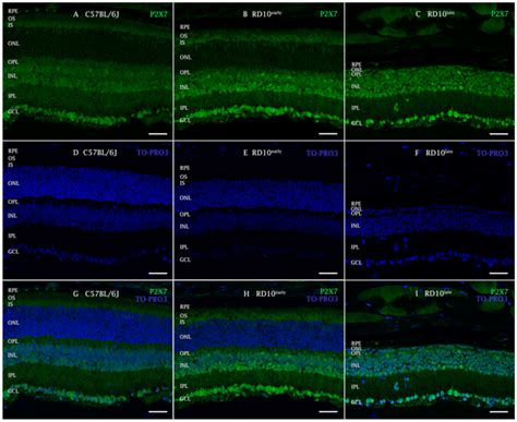 P2x7r Expression In Mouse Retinas Analyzed By Immunohistochemistry