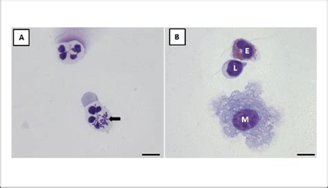 Somatic Cells Collected From Bovine Mammary Glands Stained With Download Scientific Diagram