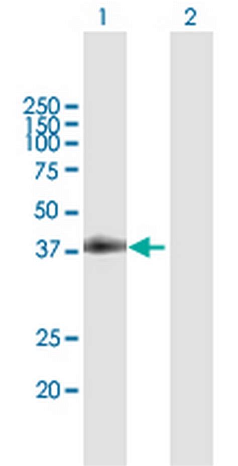 CD40 Polyclonal Antibody (H00000958-B01P)