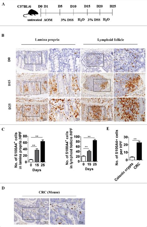 S100a4 Expression Is Associated With Aomdss Induced Colitis And Crc