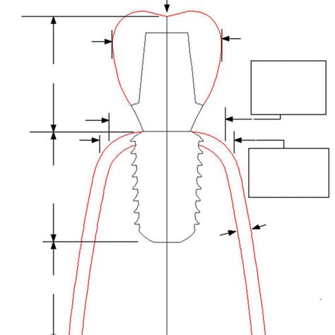 A Typical Axisymmetric Finite Element Mesh Model Base Model For