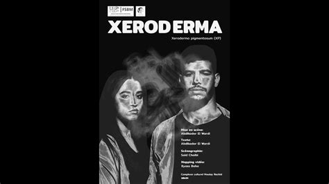 Xeroderma Youtube