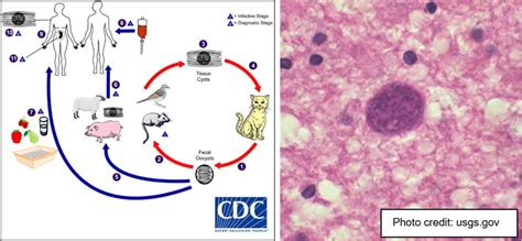 Toxoplasmosis Toxoplasma Gondii