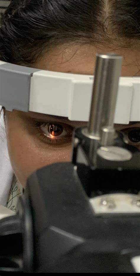 During Hands On Practice With Slit Lamp Biomicroscopy Van Herrick