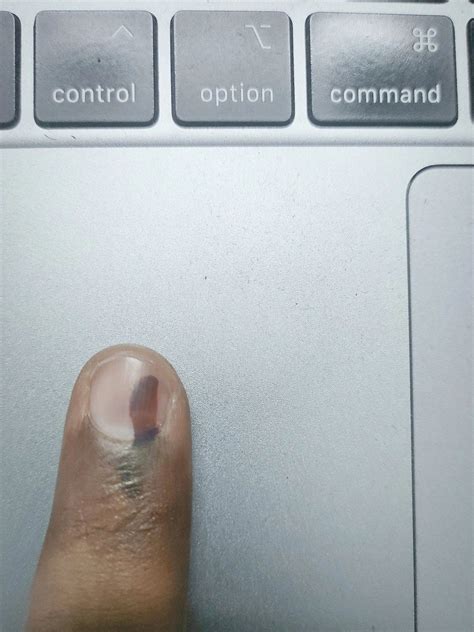 Srinivasu Nakka On Linkedin Vote Democracy
