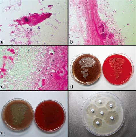 Gram Negative Streptococci