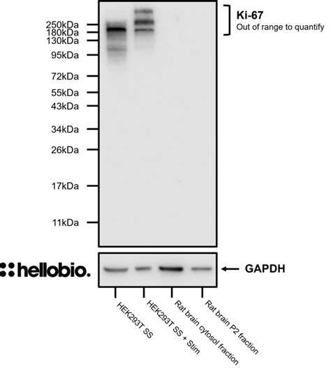 Anti Ki67 Antibody Validab™ Mouse Monoclonal Ki 67 Hello Bio
