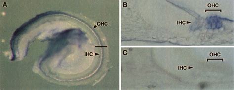 Expression Of Myosin Iiia In Mouse Cochlear Hair Cells Demonstrated By Download Scientific