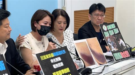 遭鍾佳濱抱摔！陳菁徽記者會痛哭 大面積瘀青照曝光｜東森新聞