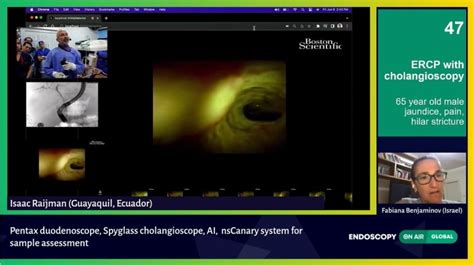 Endorx On Linkedin Ercp With Cholangioscopy Isaac Raijman Endoscopy On Air