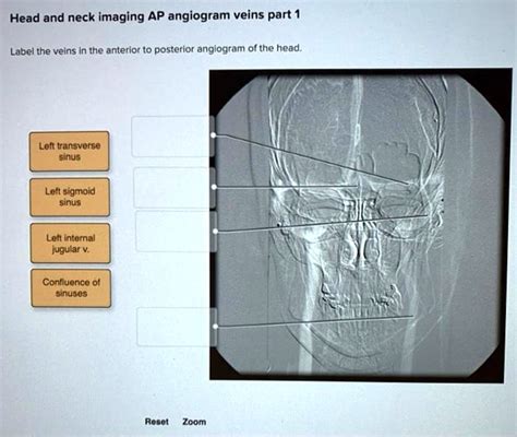 Solved Head And Neck Imaging Ap Angiogram Veins Part 1 Label The