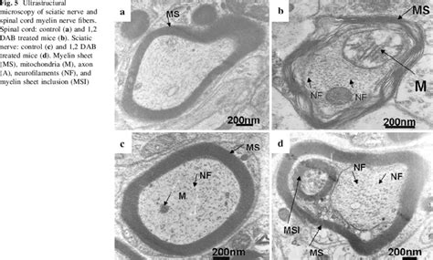 Ultrastructural Microscopy Of Sciatic Nerve And Spinal Cord Myelin