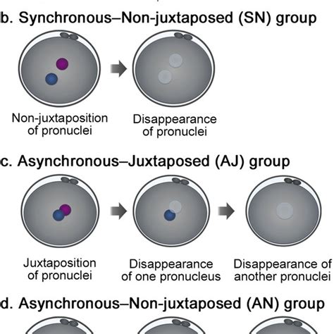 Definition Of Abnormal Pronuclei Breakdown Pnbd A The Fertilised