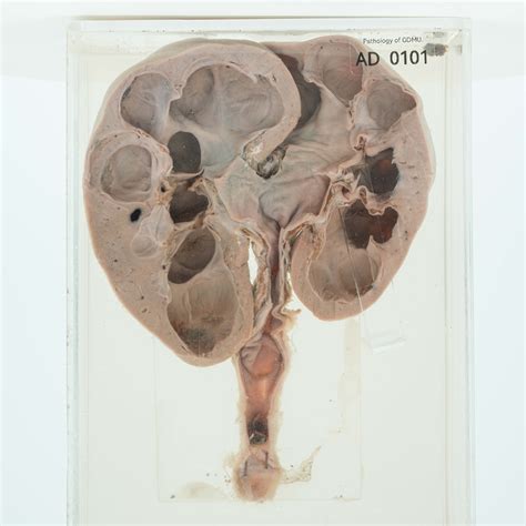 第1章 细胞、组织的适应和损伤