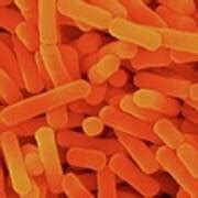 Lactobacillus Sp Gram Positive 1 Photograph By Science Photo Library