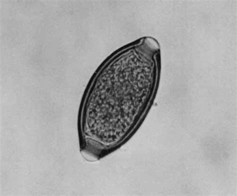 Trichuris Trichiura Egg Source From Ref 32 Download Scientific