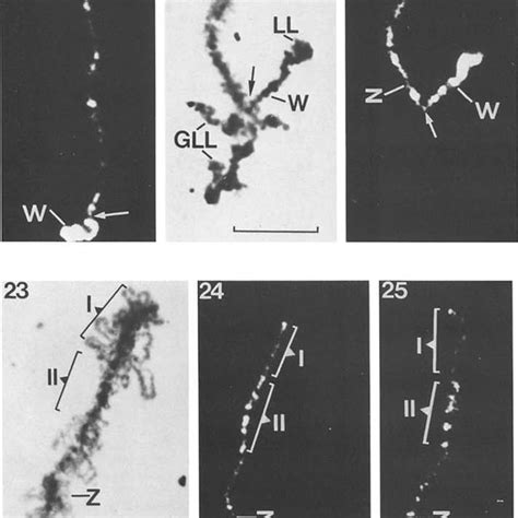 Sex Bivalents From Quail After Staining With Coomassie 23 And After