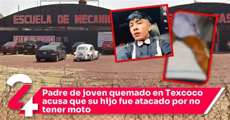 Padre De Joven Quemado En Texcoco Acusa Que Su Hijo Fue Atacado Por No Tener Moto Noticias24siete