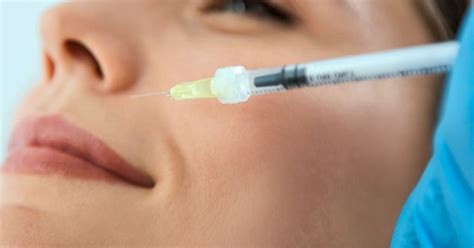 Lip Filler Swelling Stages All You Need To Know