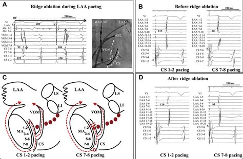 Pseudo Conduction Block Of The Mi With Mb Epicardial Connections Download Scientific Diagram