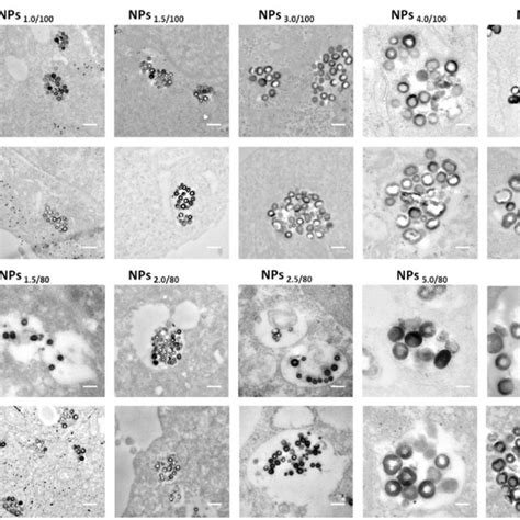 The Colocalization Of The Nanoparticle In The Endolysosomes By Cell